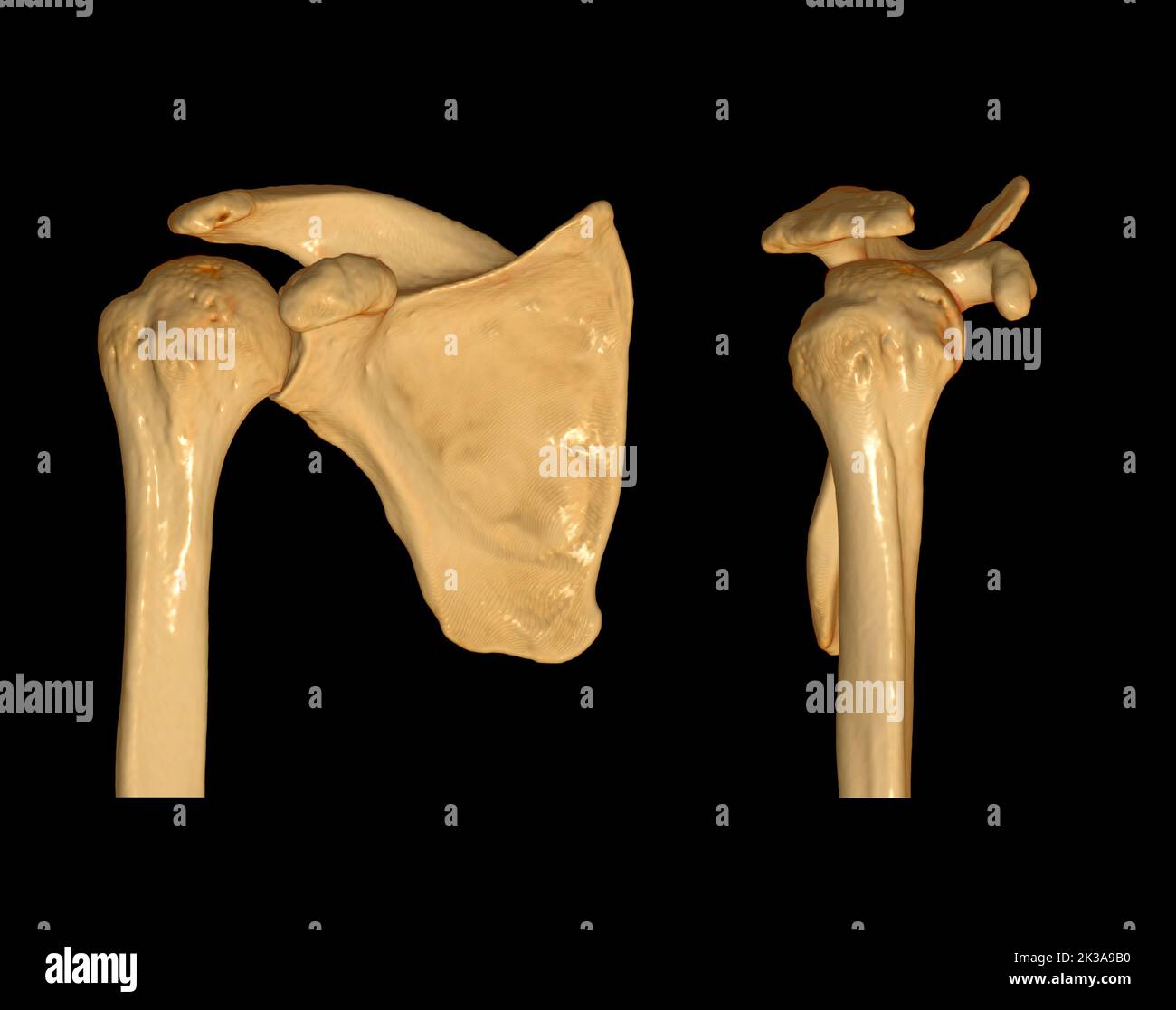 CT Shoulder 3D of Computed Tomography Volume Rendering examination of ... CT Shoulder 3D of Computed Tomography Volume Rendering examination of ...