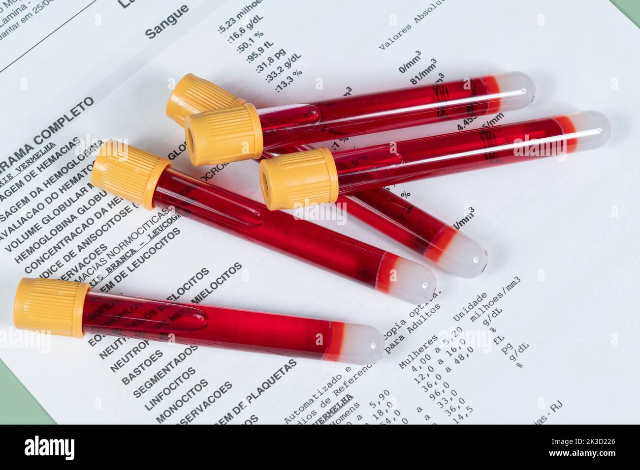 vacuum tube for blood test over clinical analysis result sheet Stock ...
