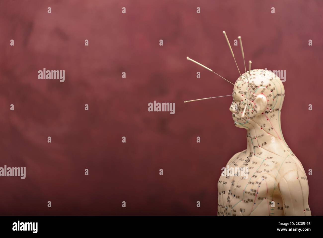 acupuncture model with needles in the head Stock Photo - Alamy
