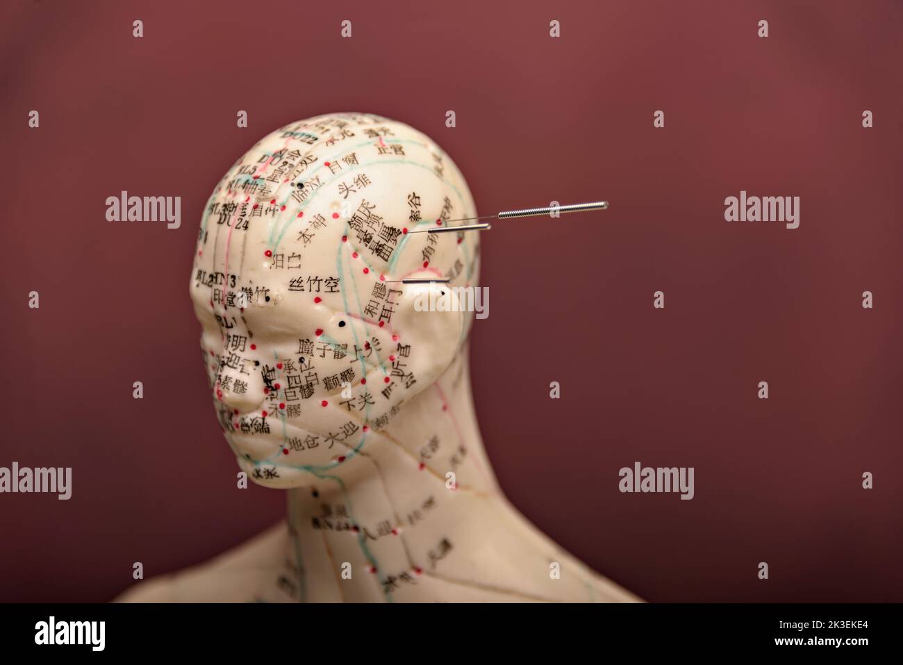acupuncture model with needles in the head Stock Photo - Alamy