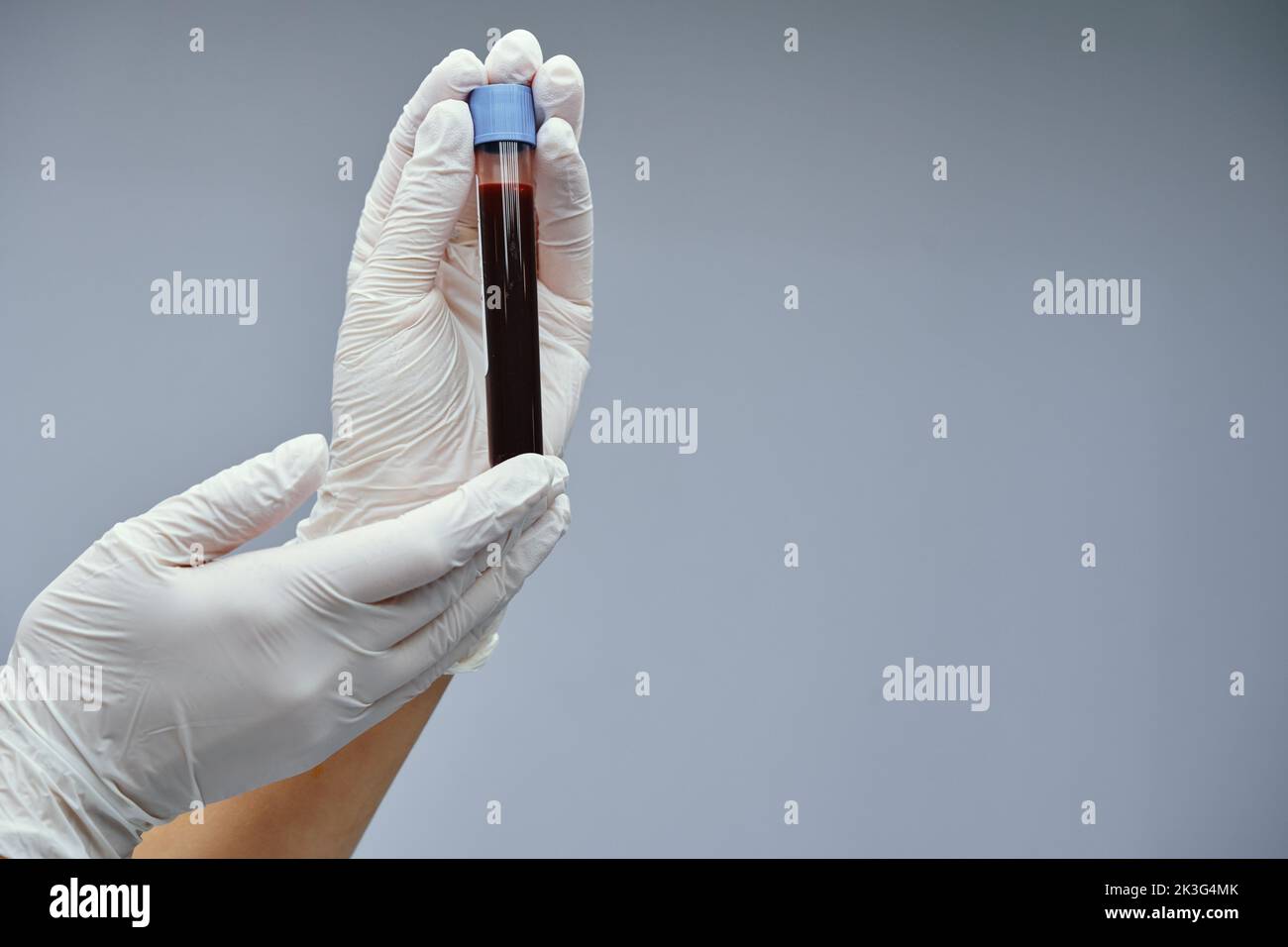 Taking a blood test hi-res stock photography and images - Alamy