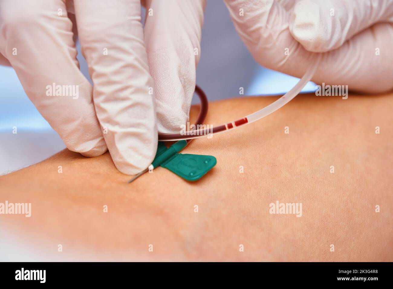 Taking a blood test Stock Photo - Alamy