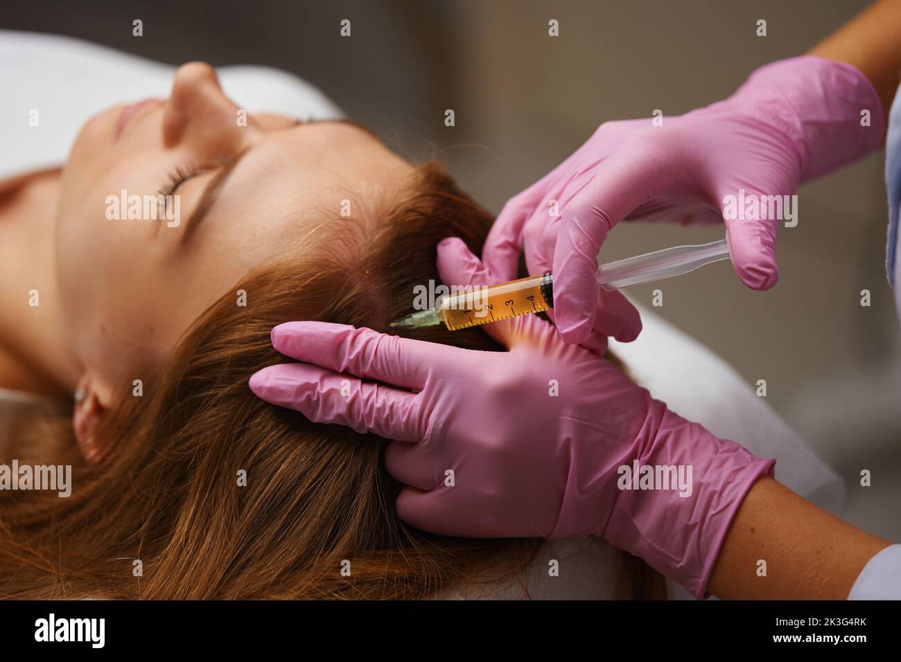 Injections of blood plasma in the face and head Stock Photo - Alamy