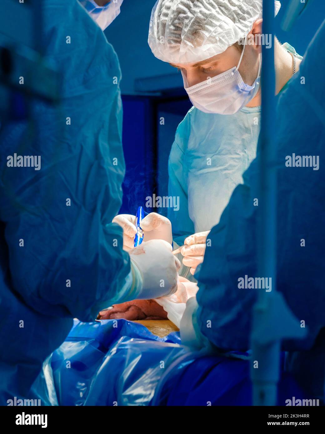 Electrosurgery on the skin hi-res stock photography and images - Alamy