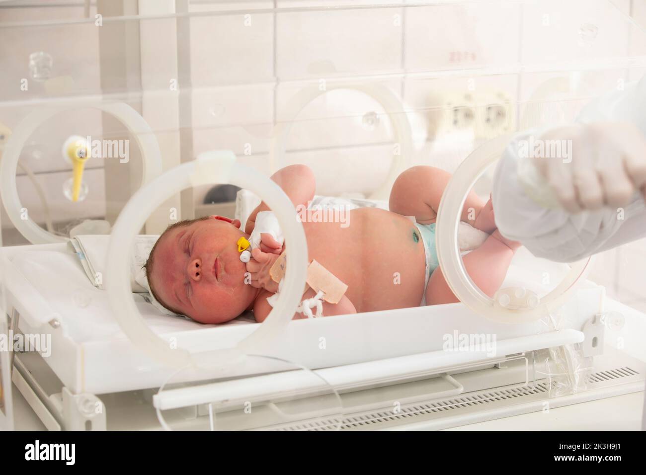 A newborn baby lies in boxes in the hospital. A child in an incubator ...