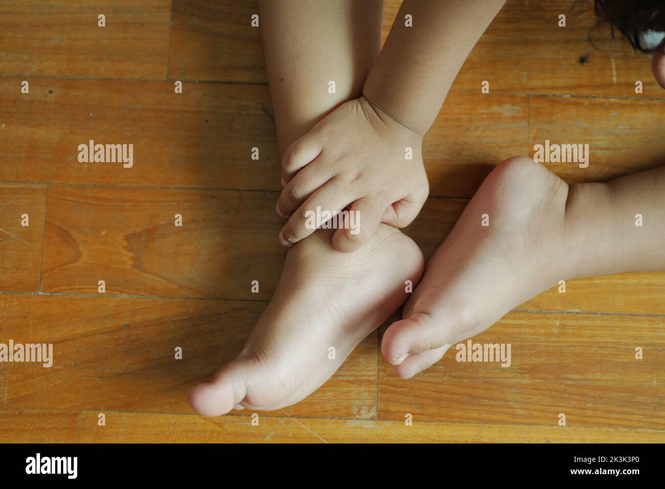 child girl suffering from itching skin, close up Stock Photo - Alamy