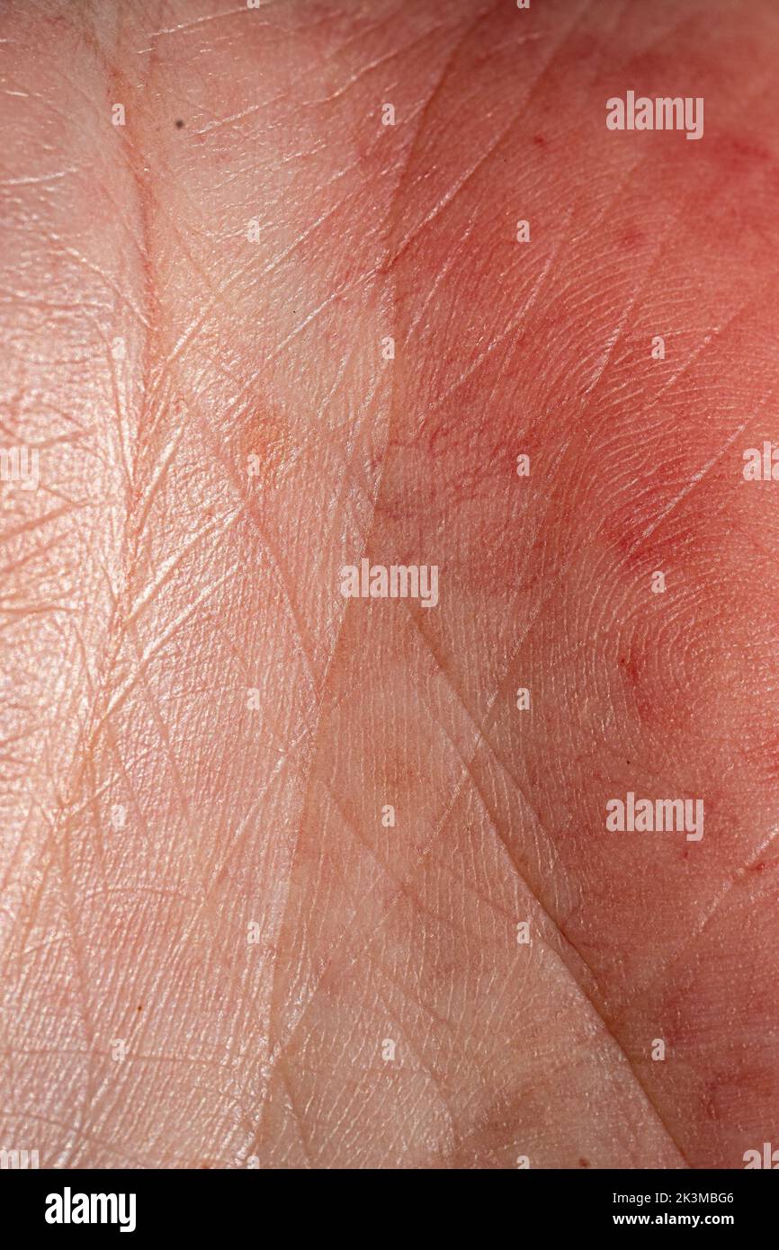 Palmar flexion creases hi-res stock photography and images - Alamy