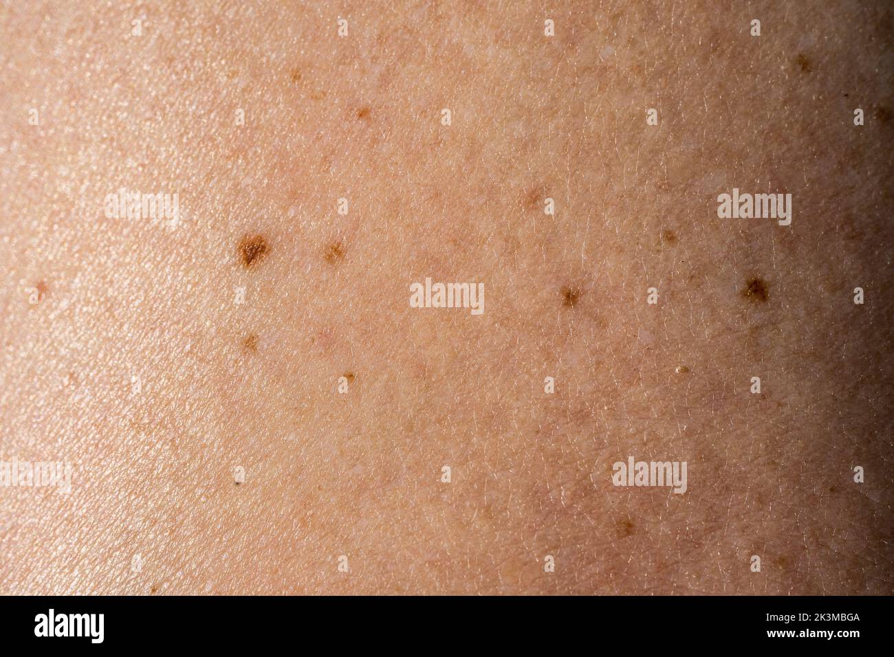 Skin macro dark hi-res stock photography and images - Alamy