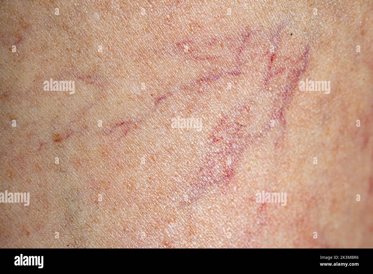 A macro shot of the human skin with veins Stock Photo - Alamy