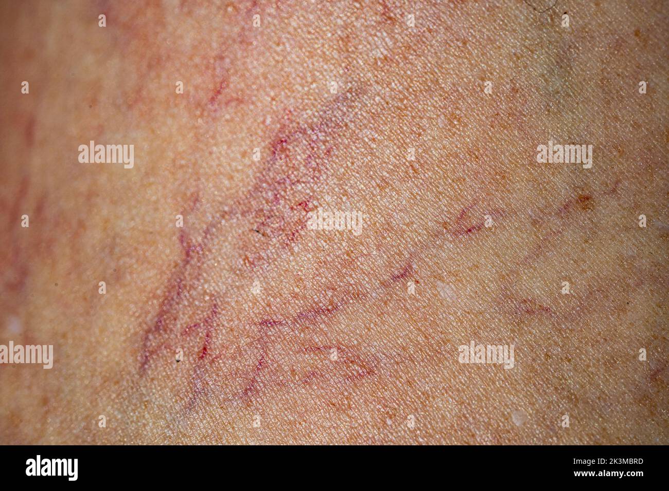 A macro shot of the human skin with veins Stock Photo - Alamy
