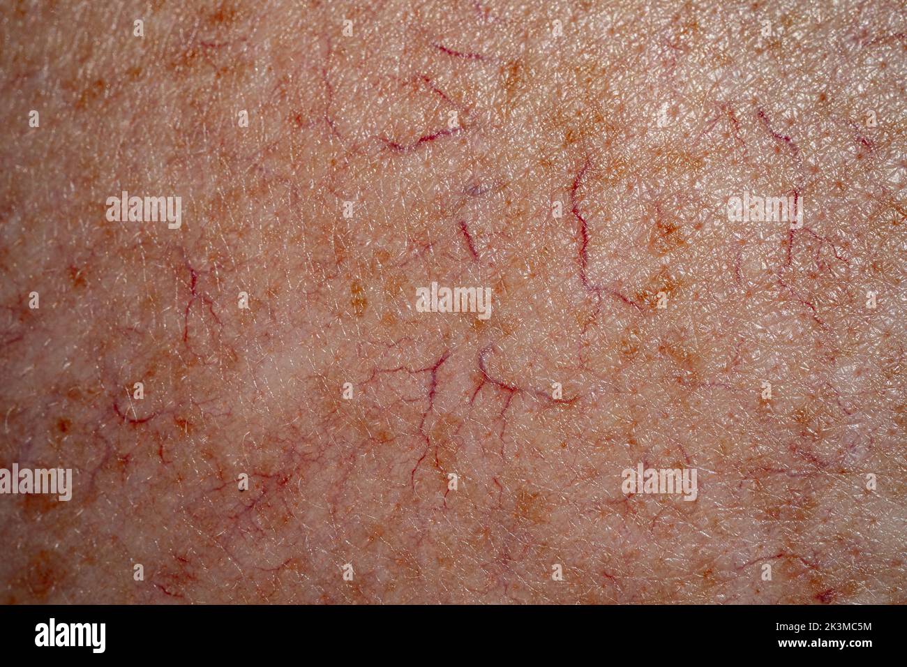 Skin veins hi-res stock photography and images - Alamy