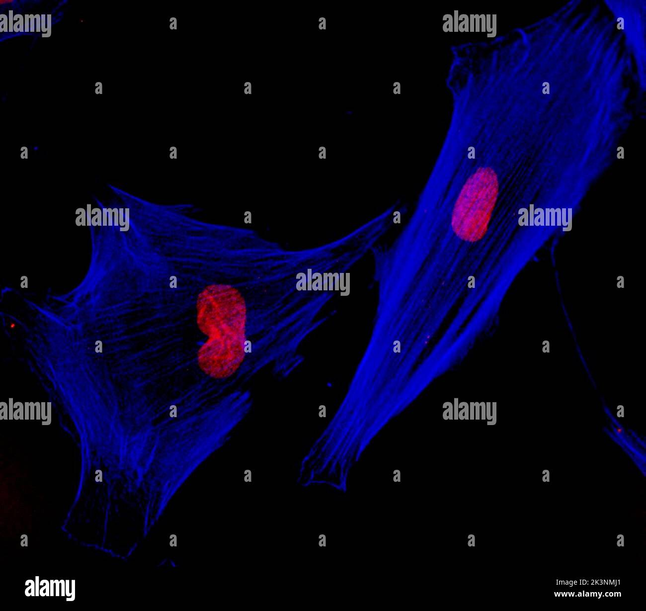 Human fibroblast cells, light micrograph Stock Photo - Alamy