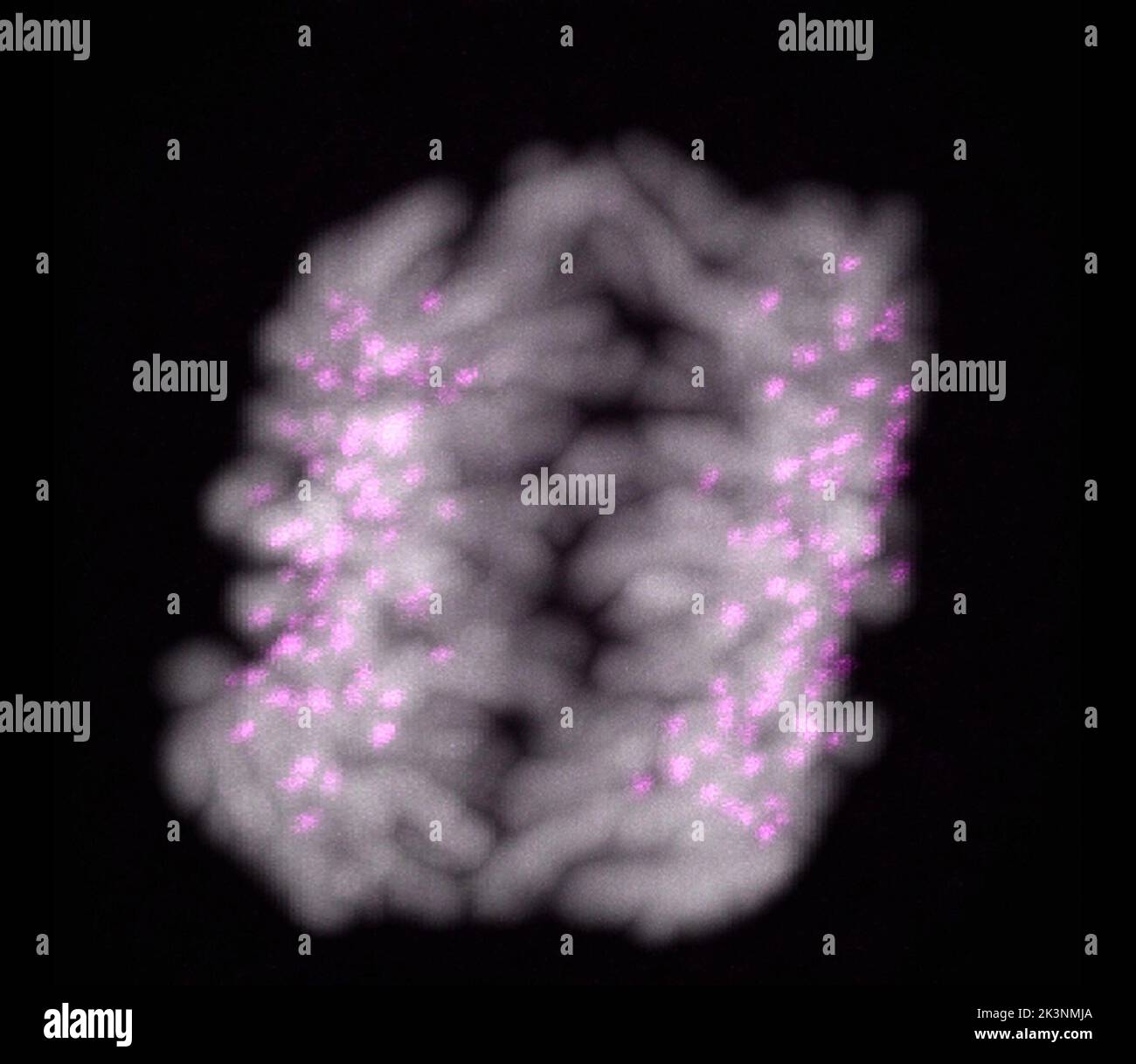 Human chromosomes in early anaphase, light micrograph Stock Photo - Alamy