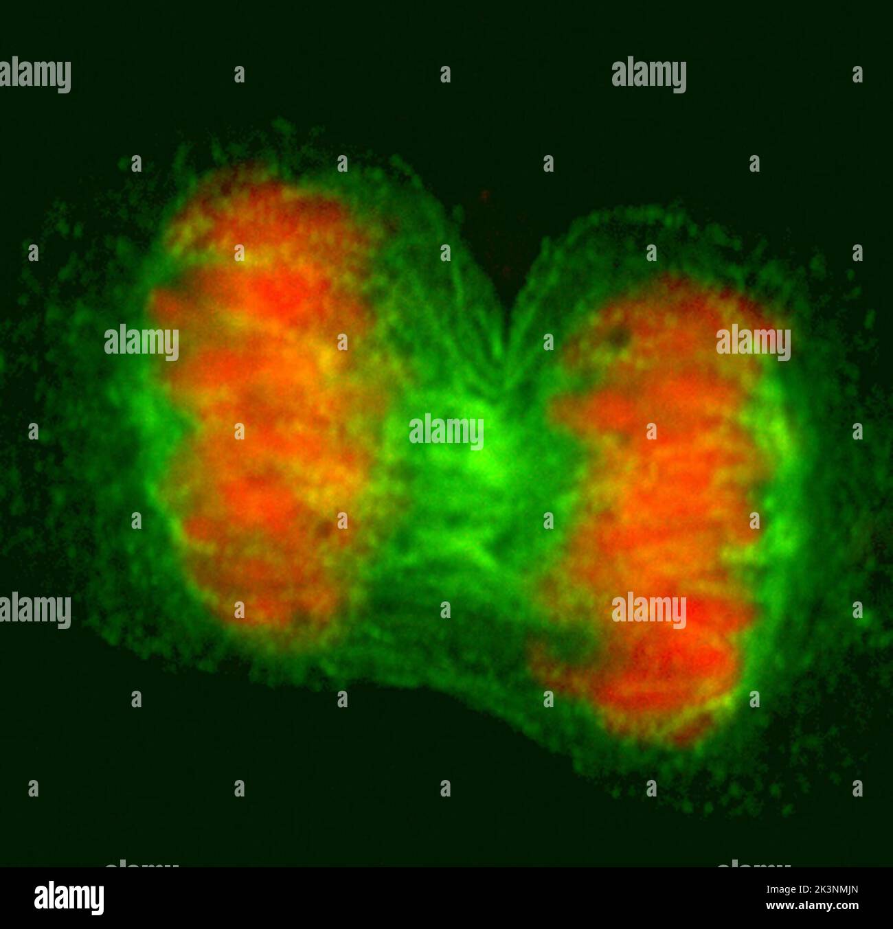 Human cell in anaphase, light micrograph Stock Photo - Alamy