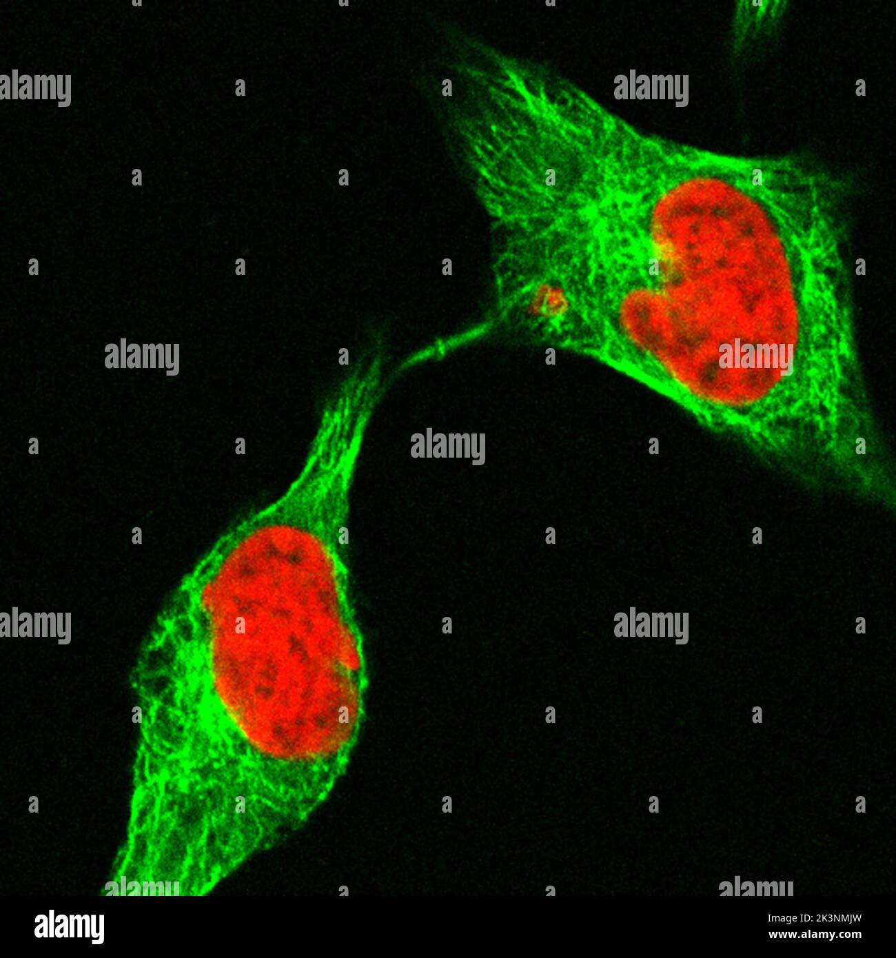 Human cell late in cytokinesis, light micrograph Stock Photo - Alamy