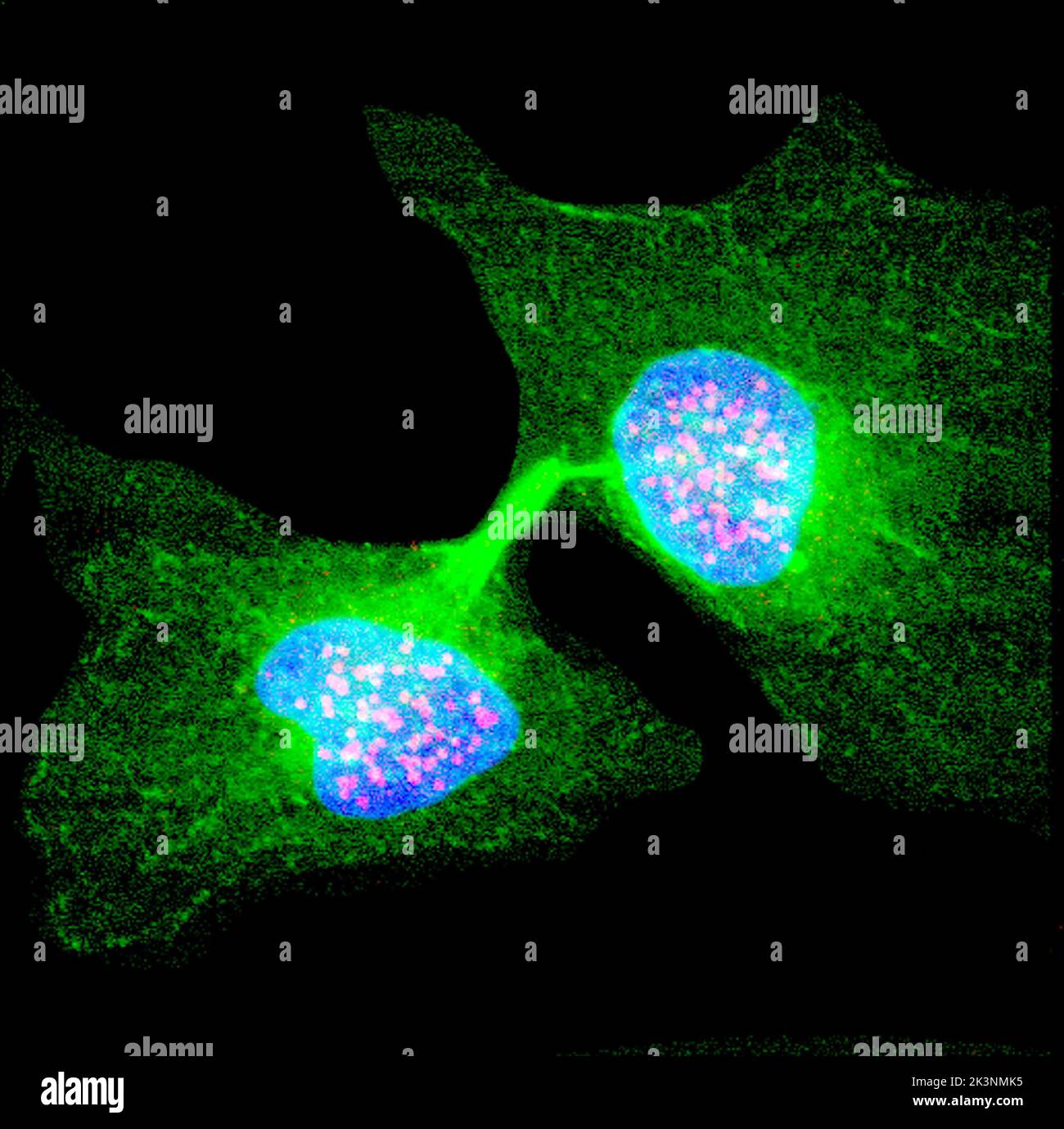 Human cell in telophase, light micrograph Stock Photo - Alamy