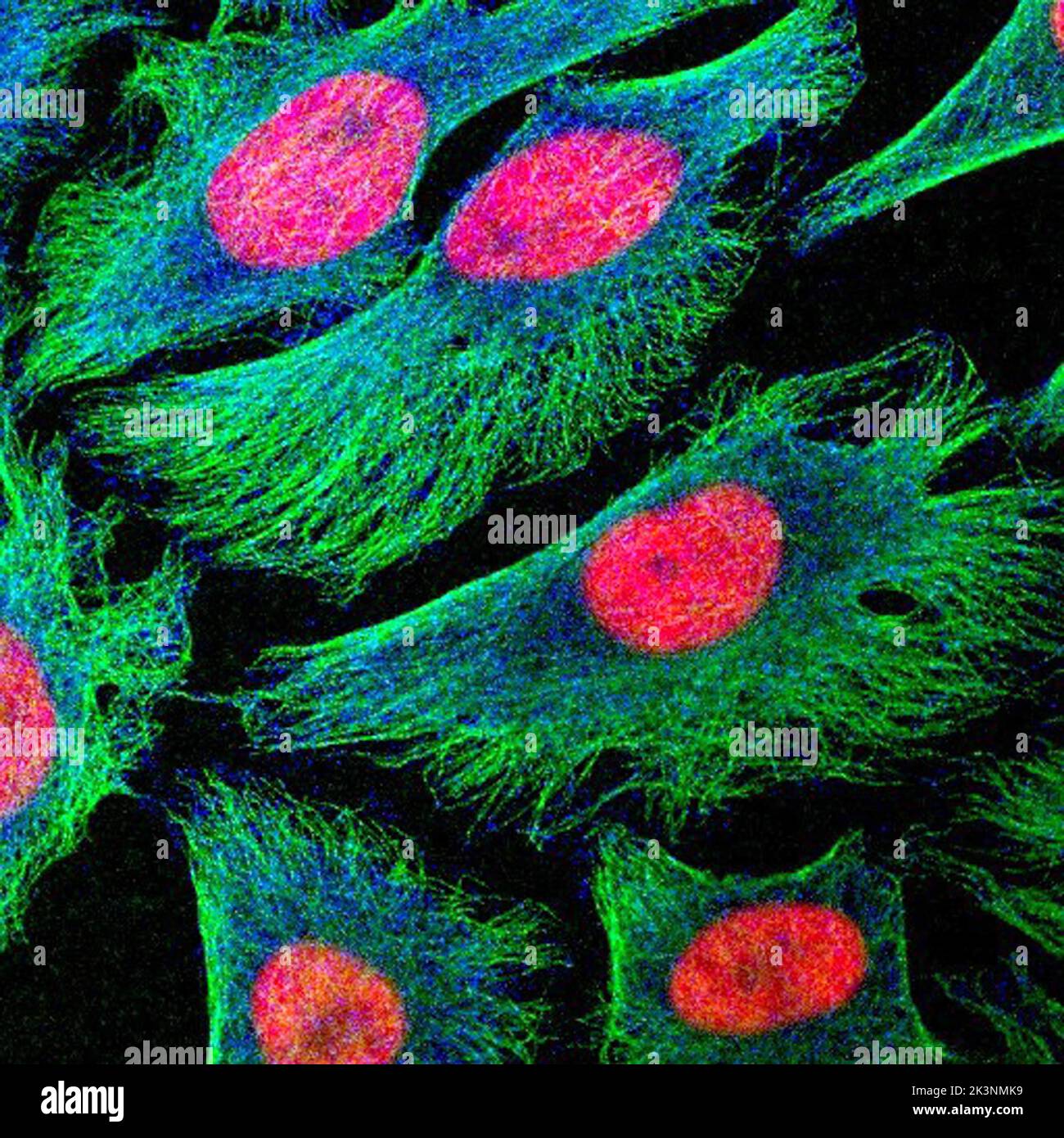 Human cancer cells in culture, light micrograph Stock Photo - Alamy