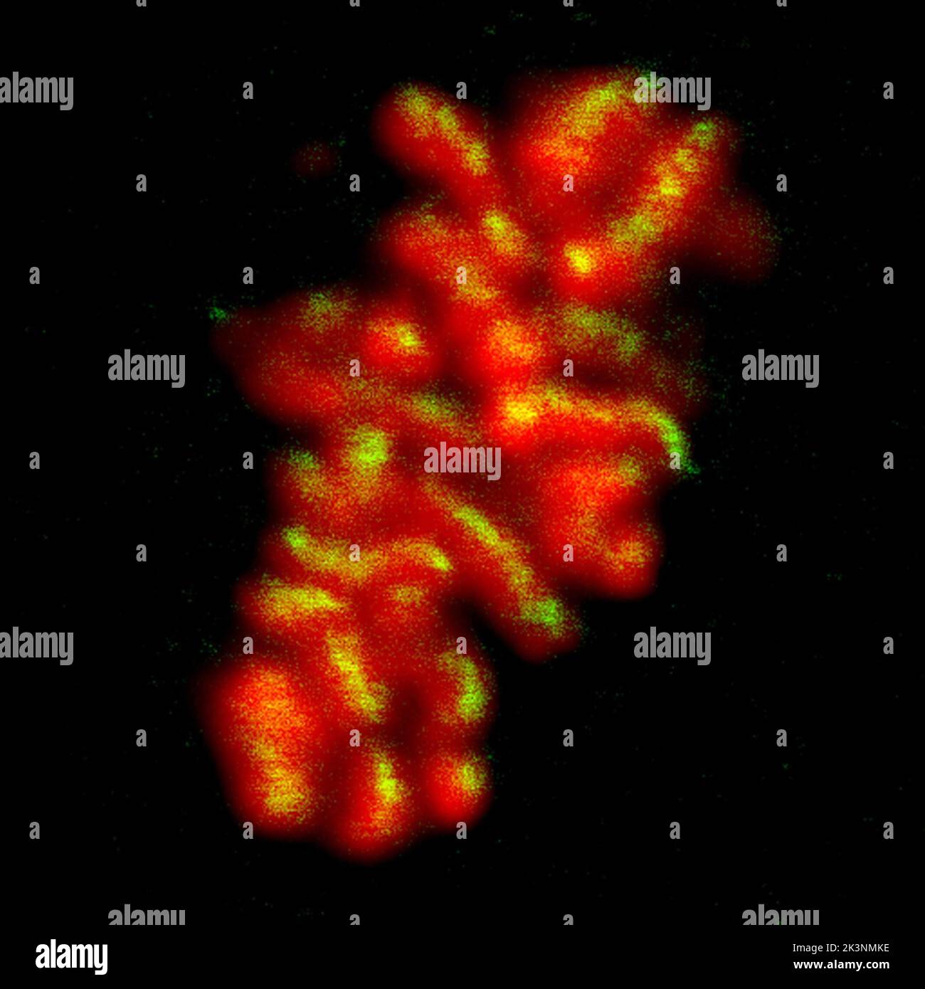 Human chromosomes in metaphase, light micrograph Stock Photo - Alamy