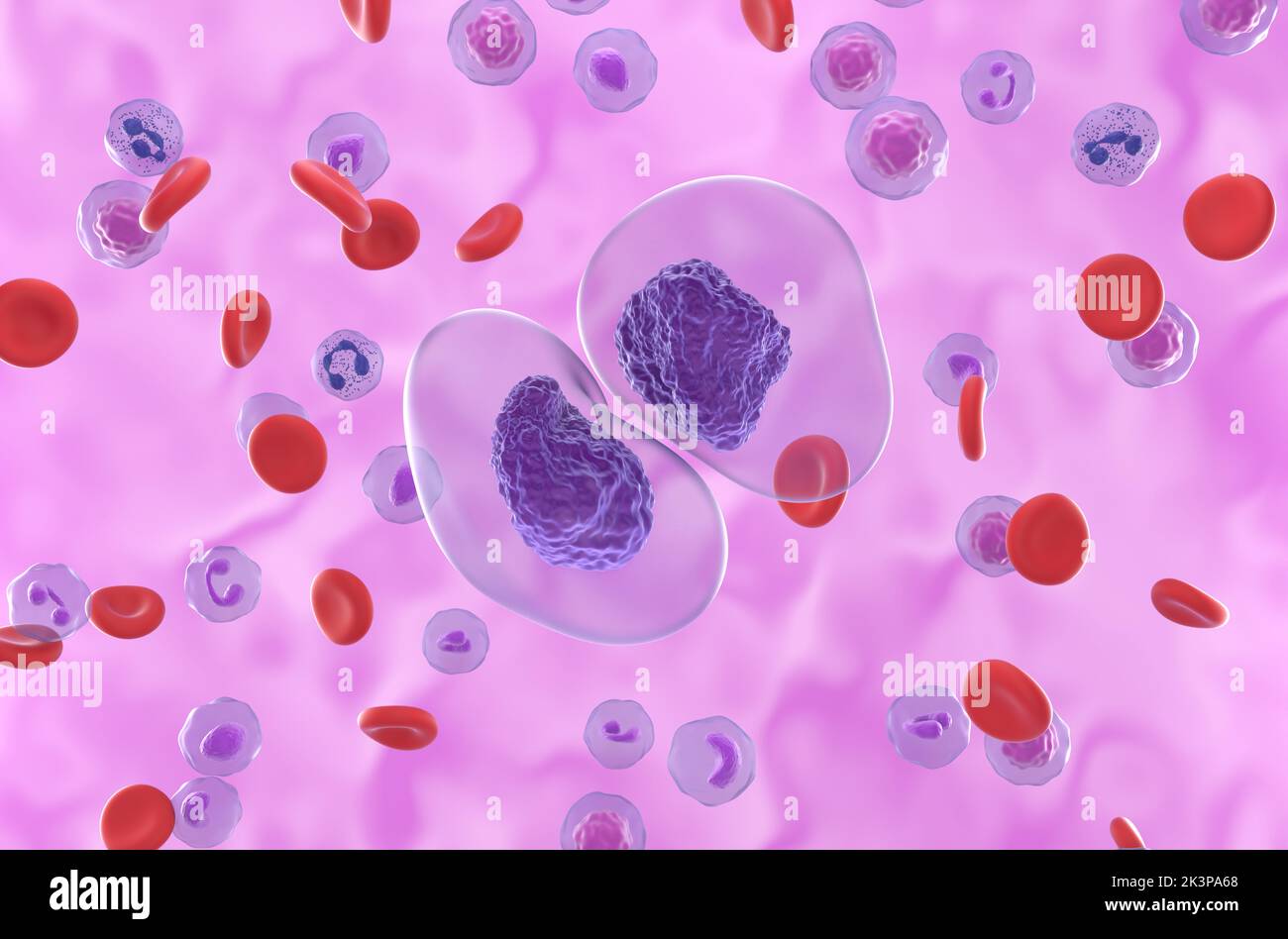 Prolymphocytic Leukemia (PLL) cancer cells - closeup view 3d ...