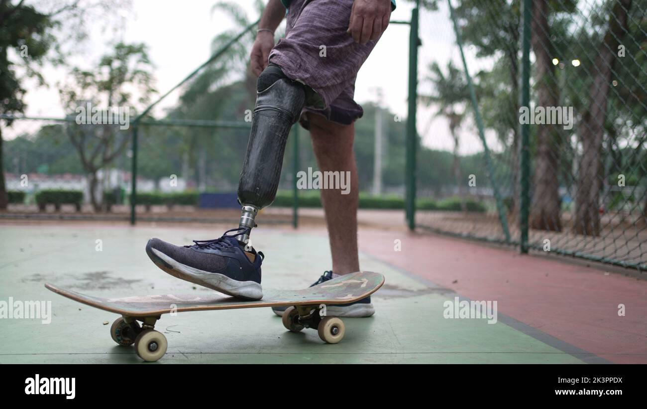 Skateboarder standing with his prosthetic leg. Disabled person with ...