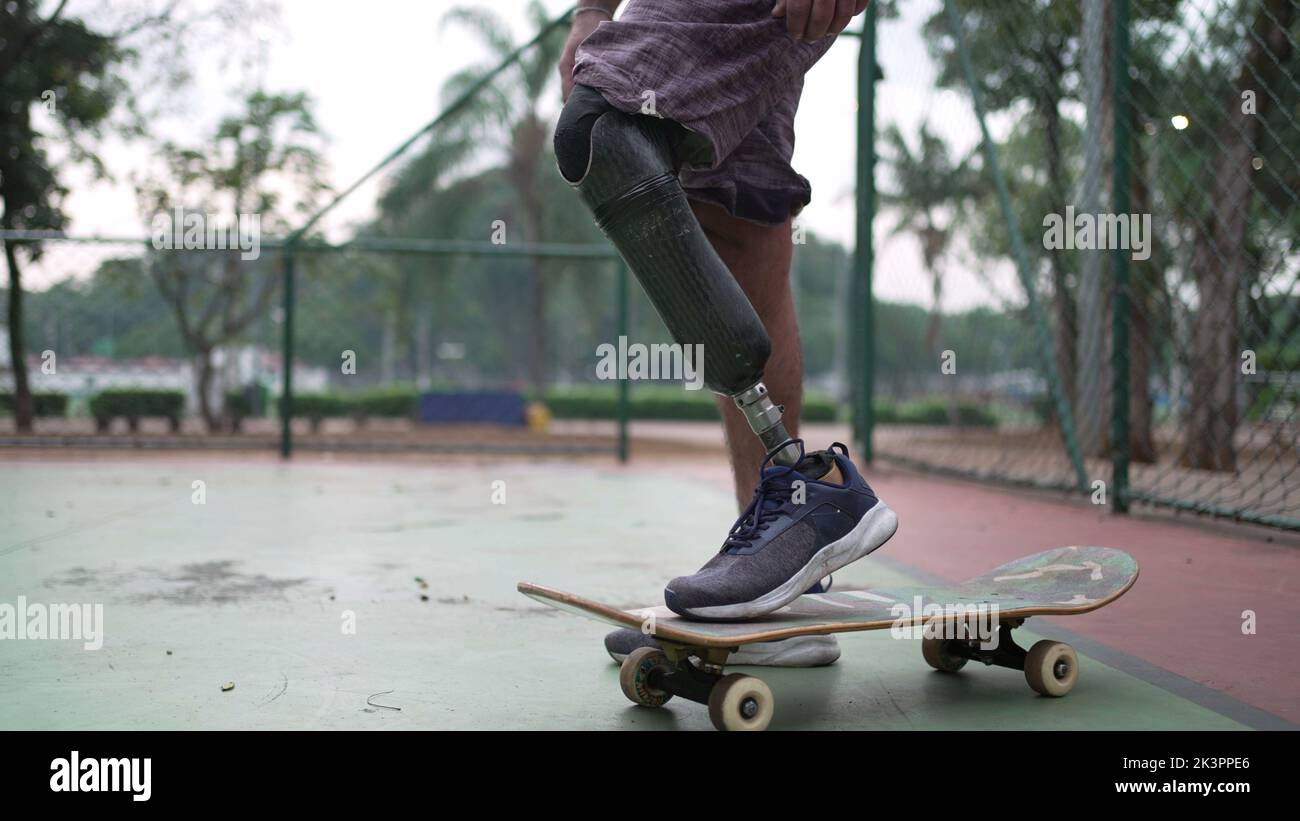 Skateboarder standing with his prosthetic leg. Disabled person with ...