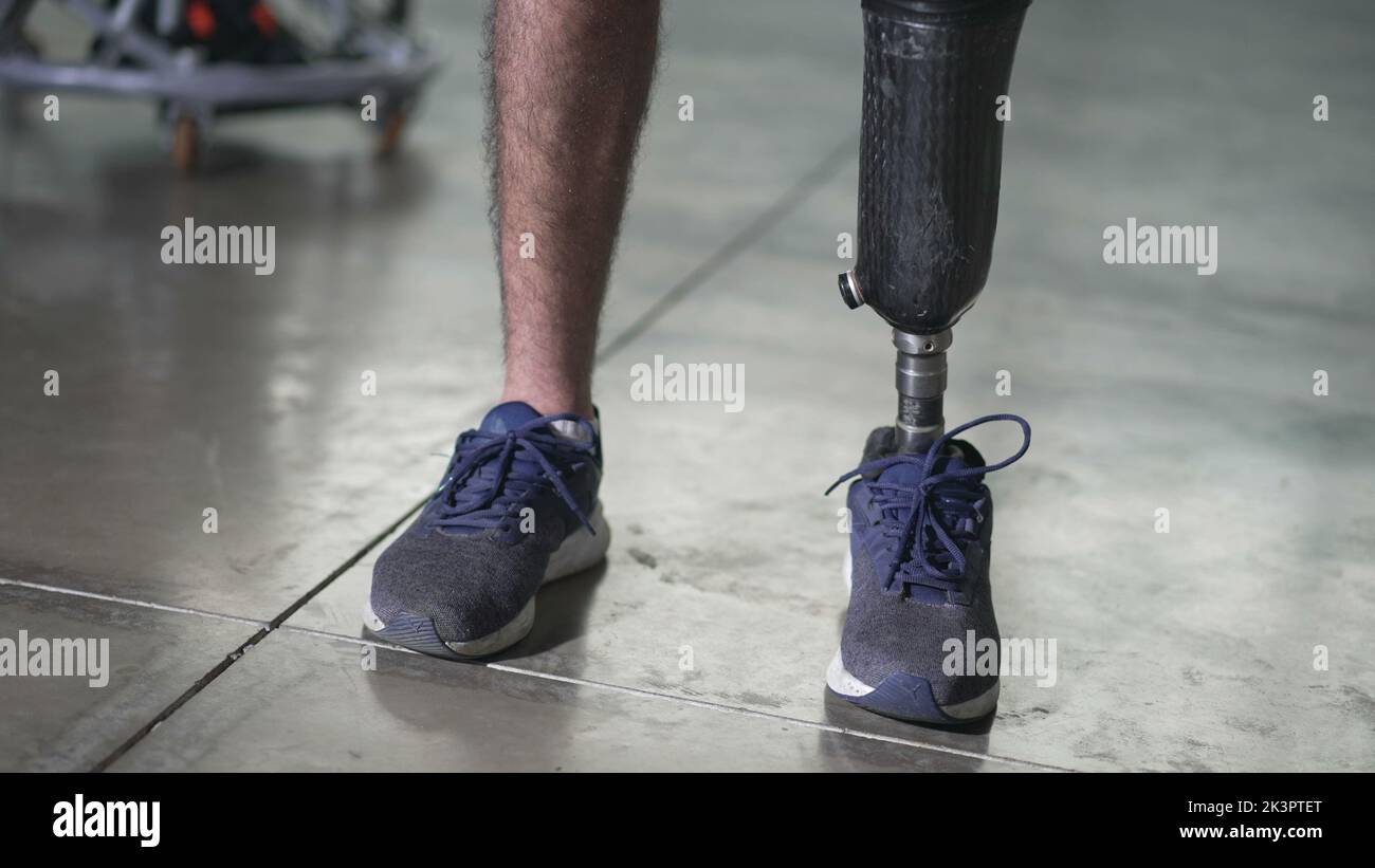 Closeup person wearing a prosthetic leg standing with artificial ...