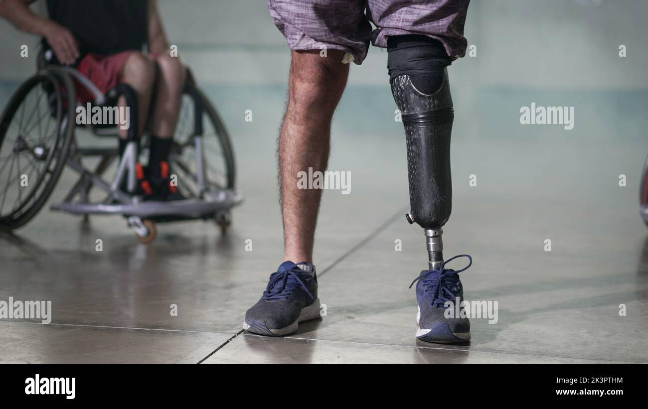 Disabled person standing with prosthetic leg. Person on wheelchair in ...