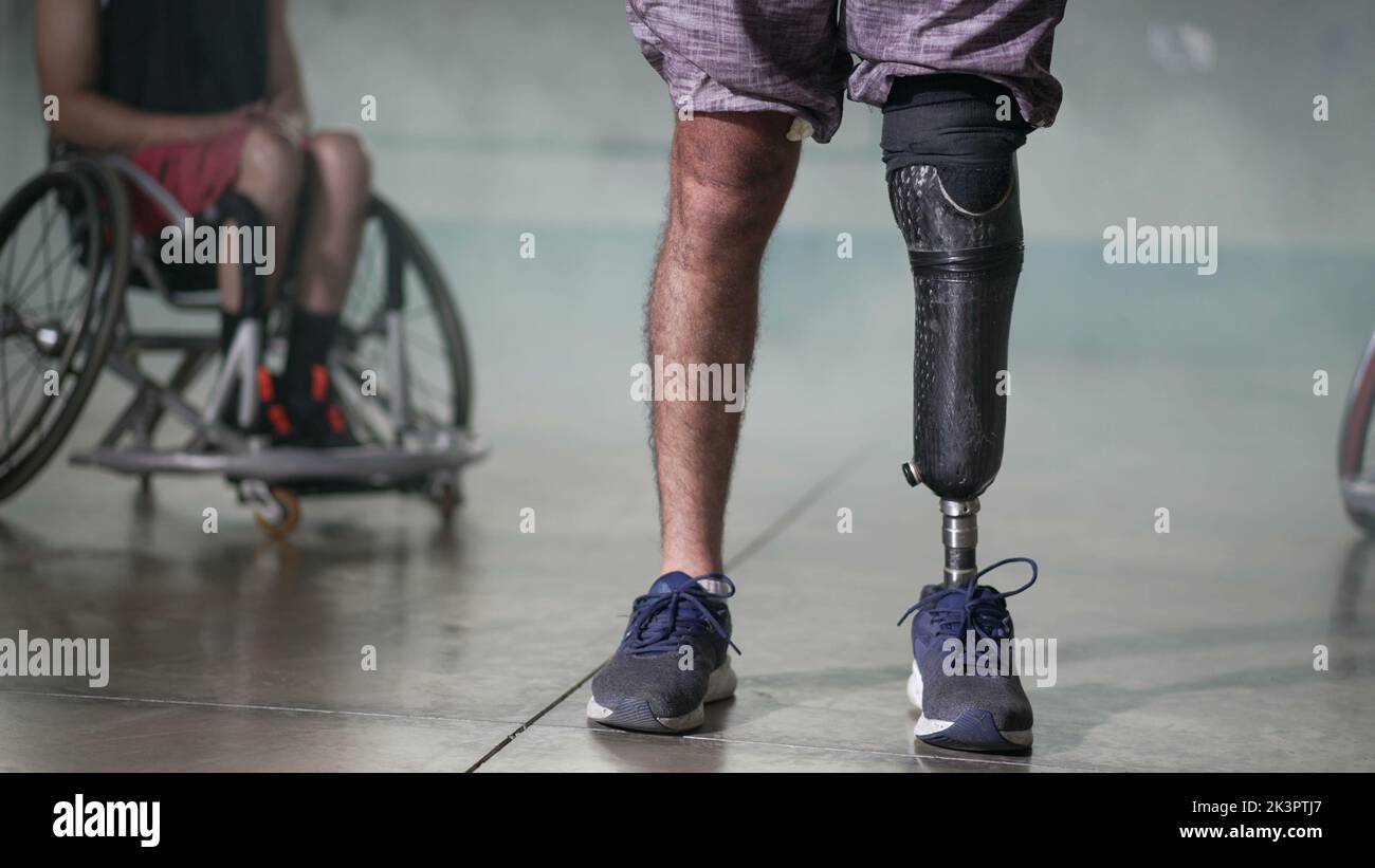 Disabled person standing with prosthetic leg. Person on wheelchair in ...