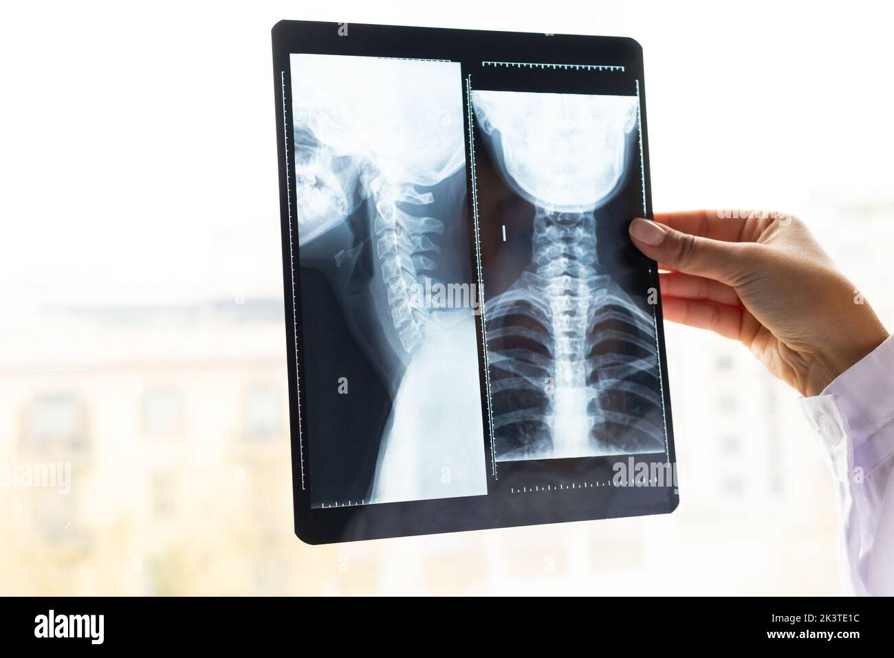 Anonymous ethnic female medic in uniform studying X ray image of spine ...