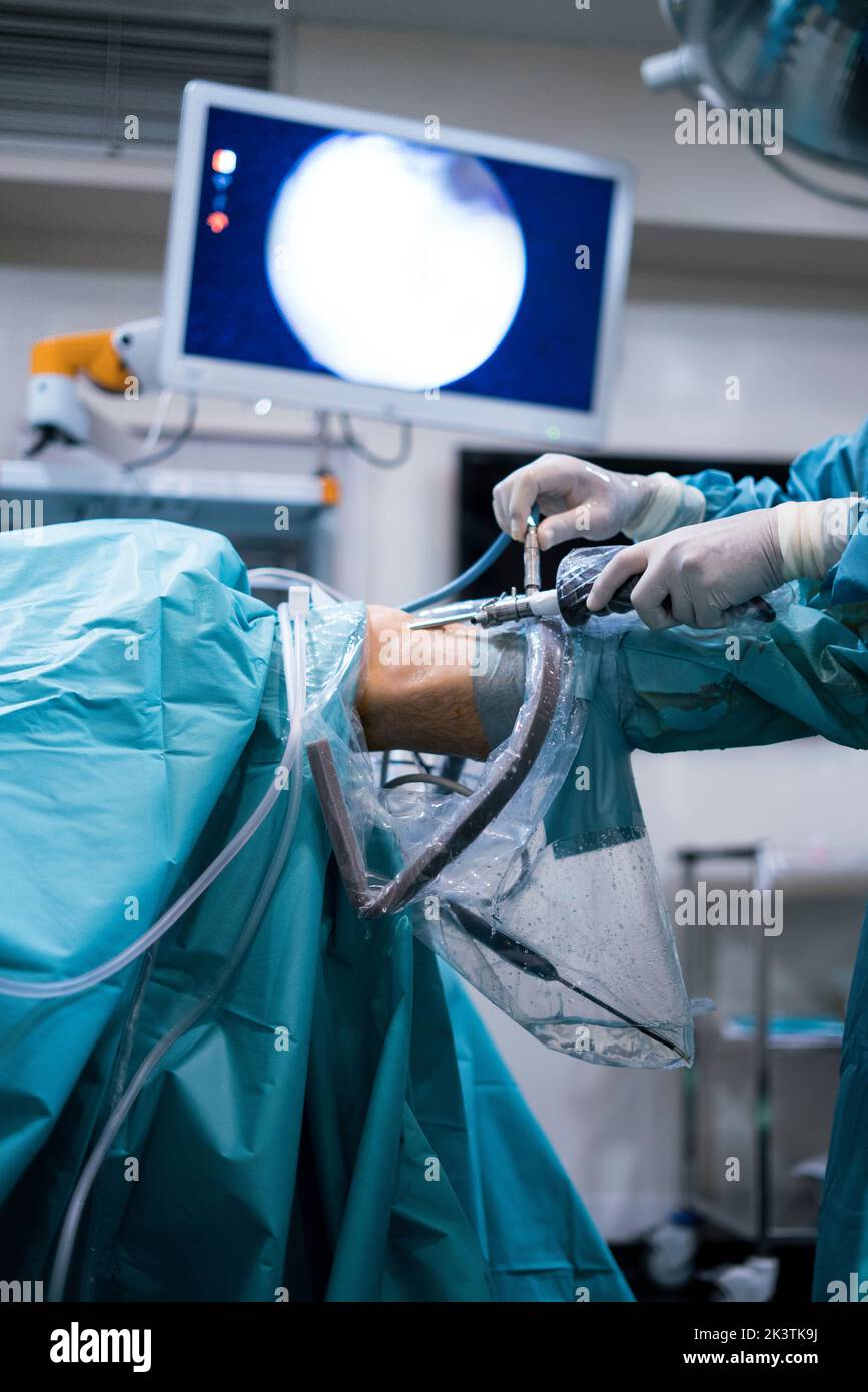 Crop hands of surgeon in gloves inserting endoscope into knee of ...