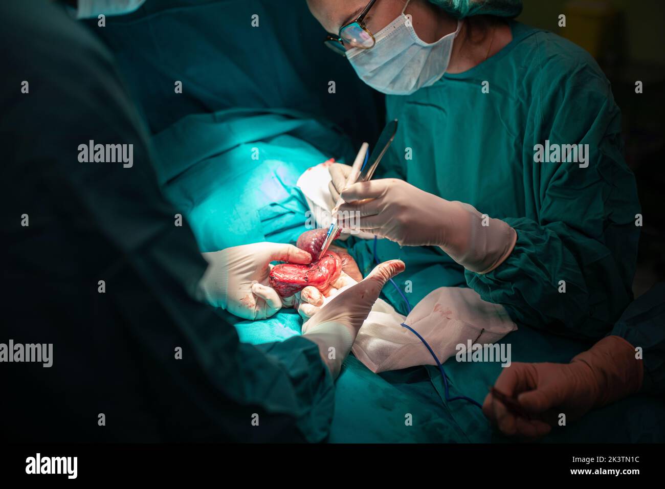 Female doctor in medical uniform performing surgery through cut on ...