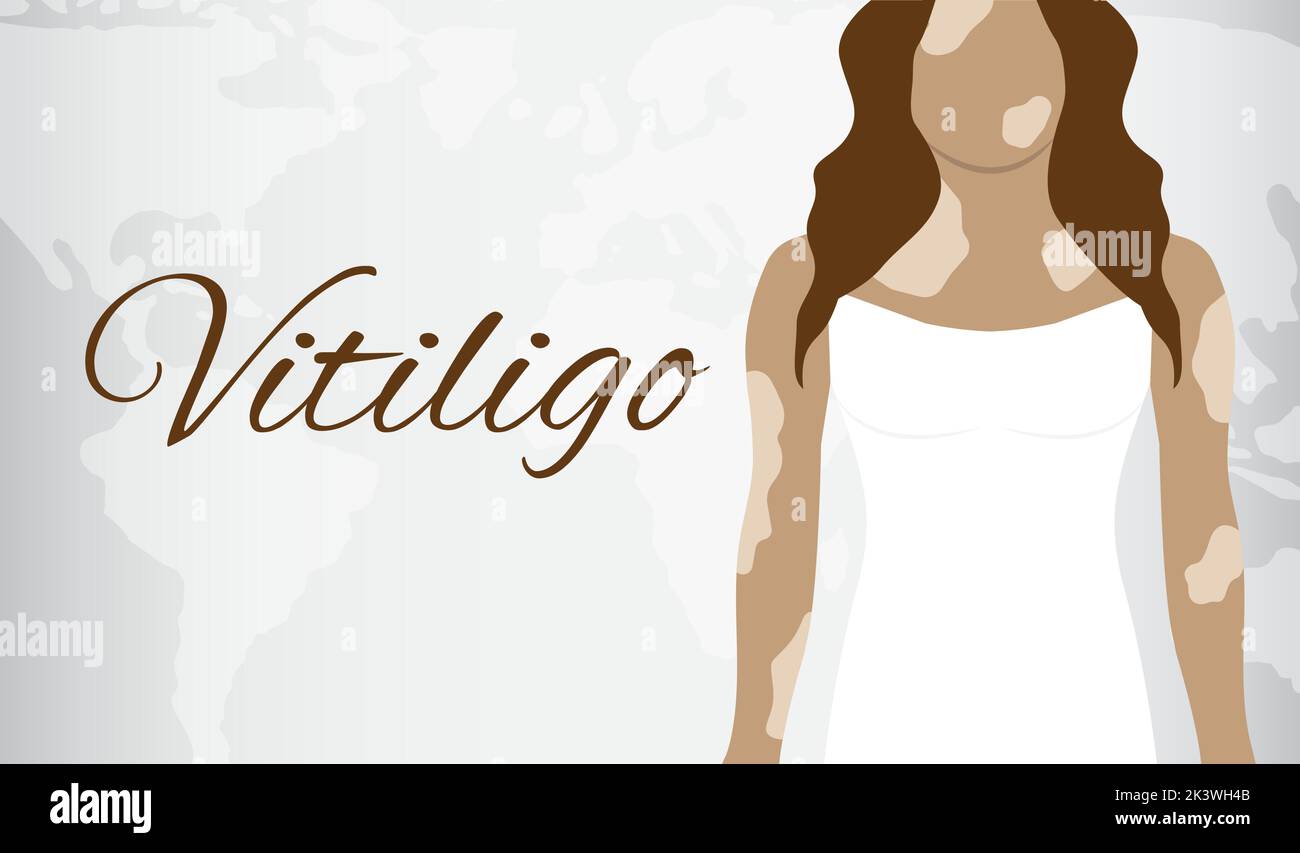 Vitiligo Skin Illness Illustration with World Map Background Stock ...