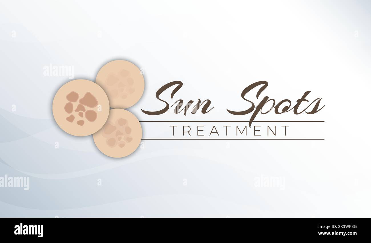 Sun Spots Removal Treatment Illustration Background Design Stock Vector ...