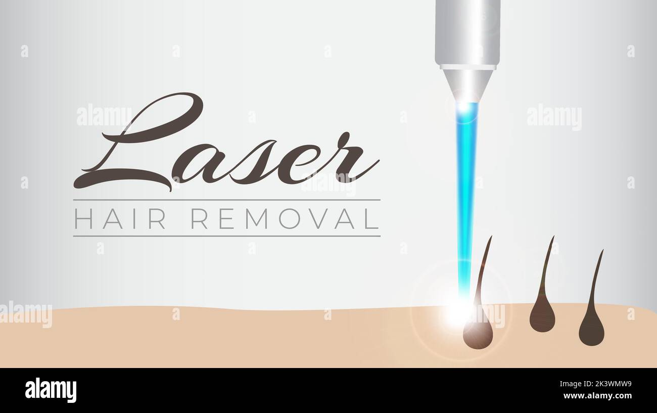 Laser Hair Removal Background Illustration Design Stock Vector Image ...