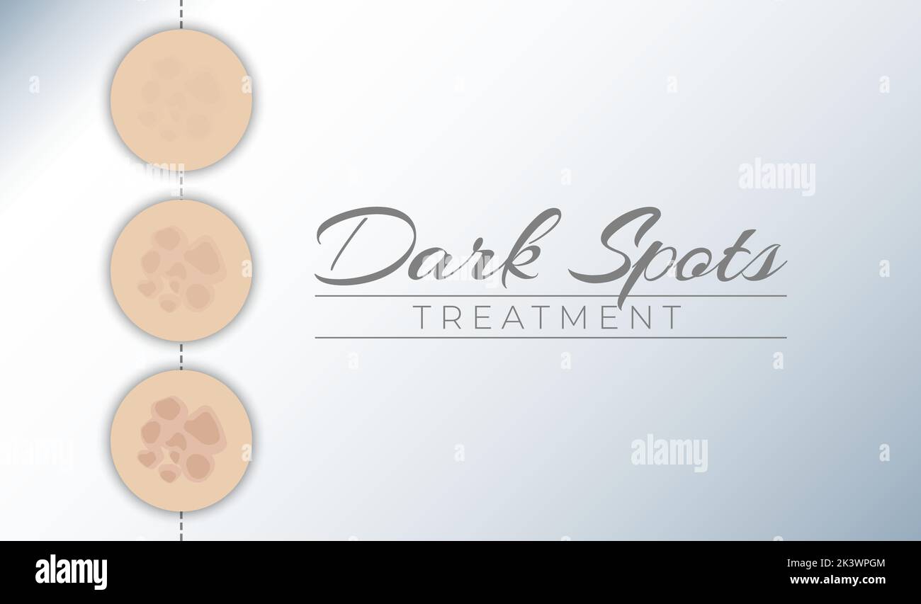 Dark steps Stock Vector Images - Alamy