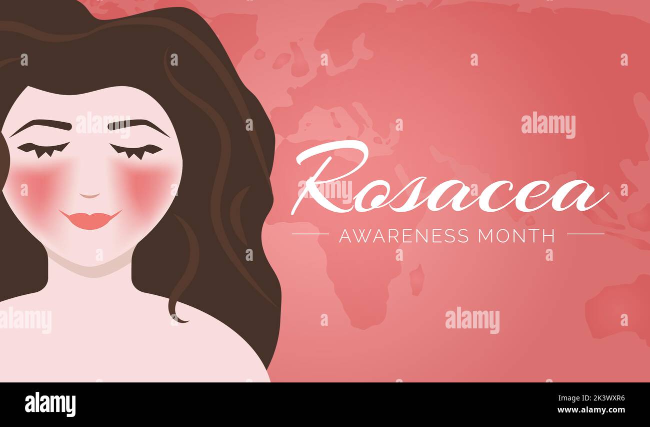 Rosacea Awareness Month Background Illustration Stock Vector Image