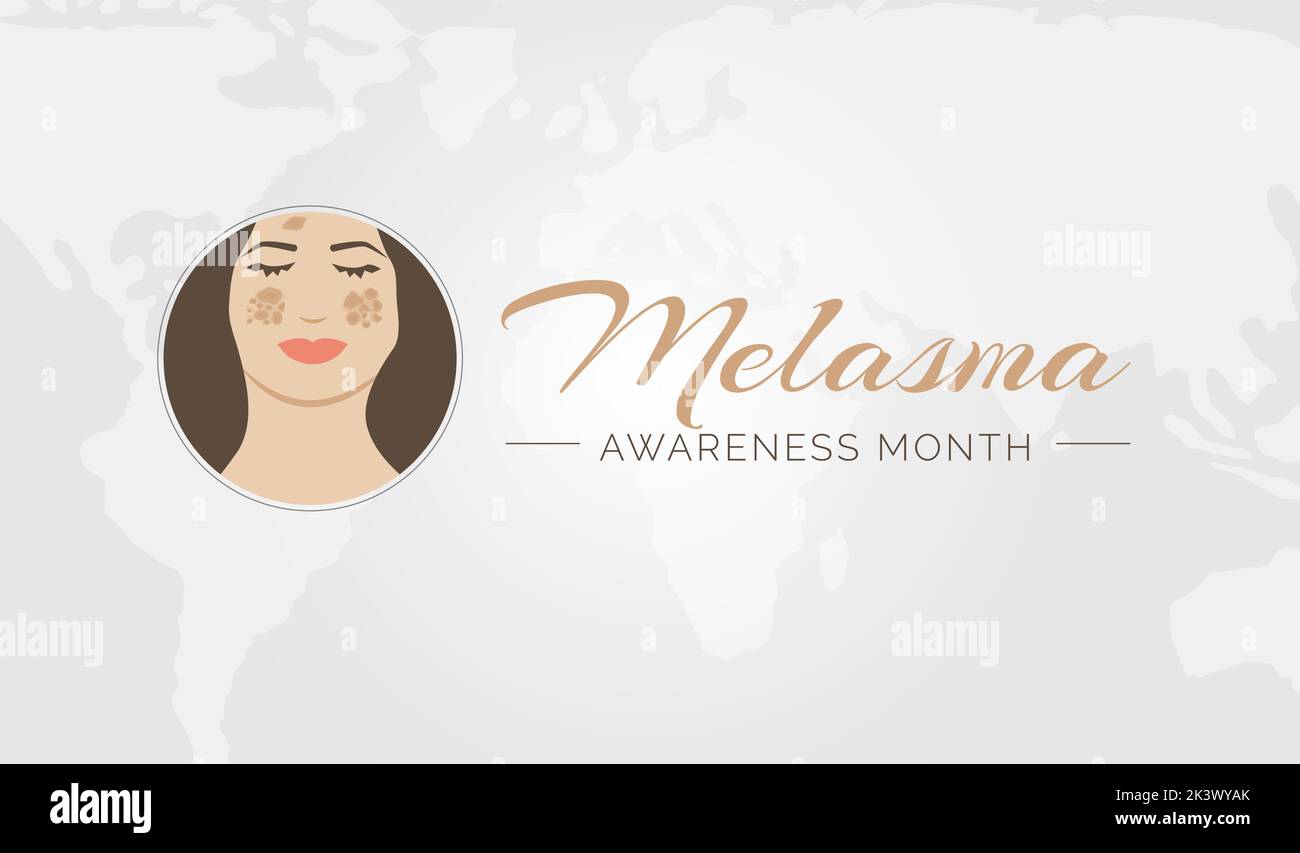 Melasma Awareness Month Vector Illustration Design Stock Vector Image ...