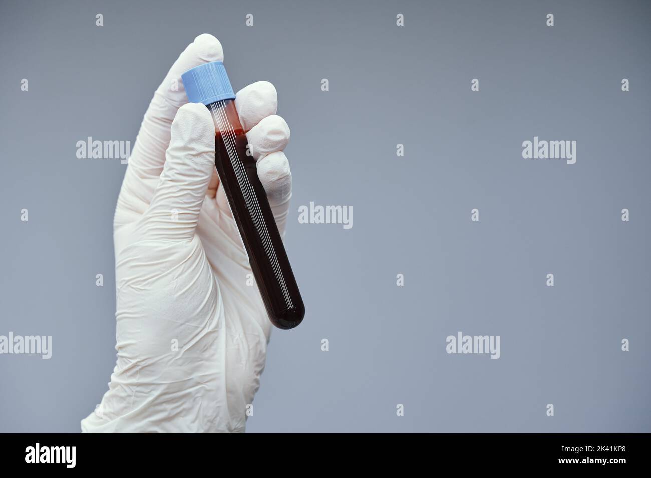 Arterial blood sample hi-res stock photography and images - Alamy