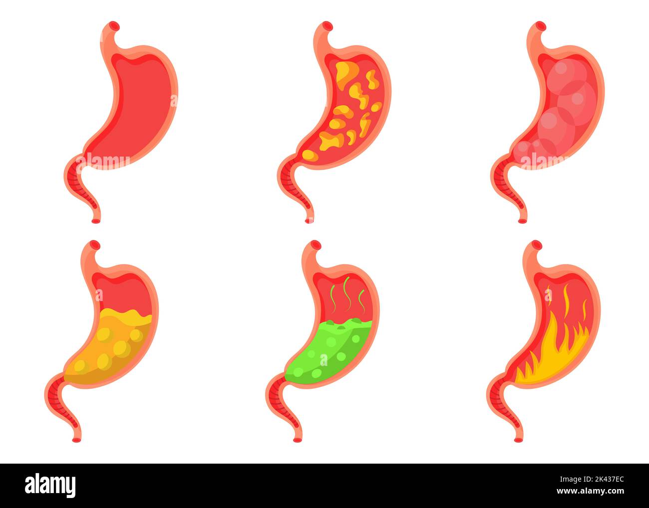 Set empty and full stomach. Heaviness of stomach, bloating, pain in the ...