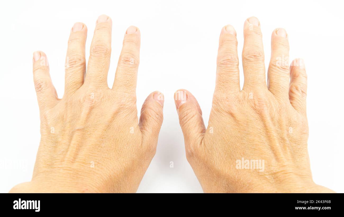 Hands of a middle aged woman on the white background. Wrinkles on woman ...