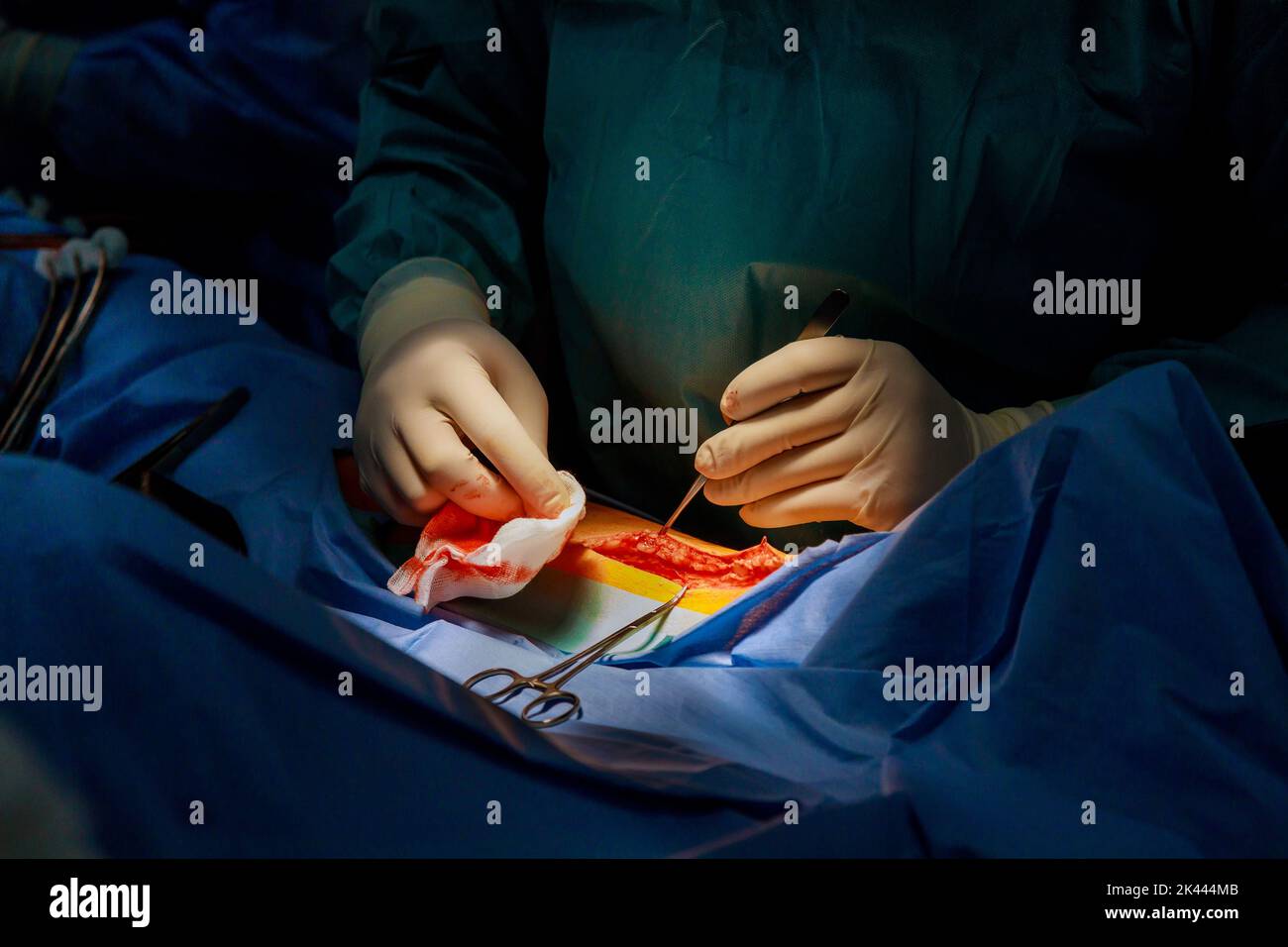 Doctor sewing on wound in operating room in hospital Stock Photo - Alamy