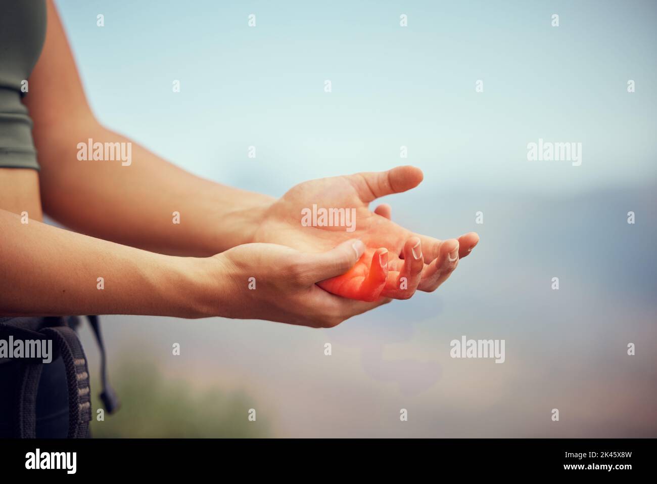 Swollen palm of hand hi-res stock photography and images - Alamy