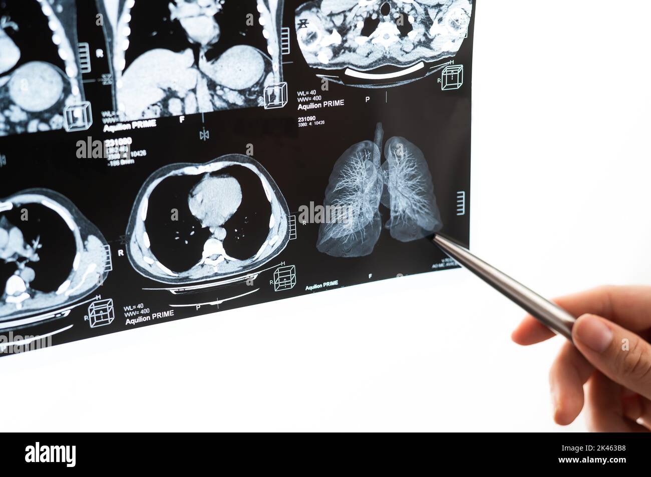 A female doctor examines an MRI scan of the internal organs. Abdomen ...
