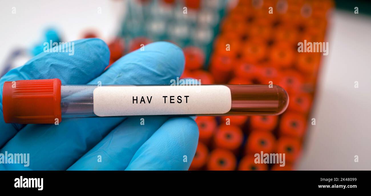 Hav test hi-res stock photography and images - Alamy