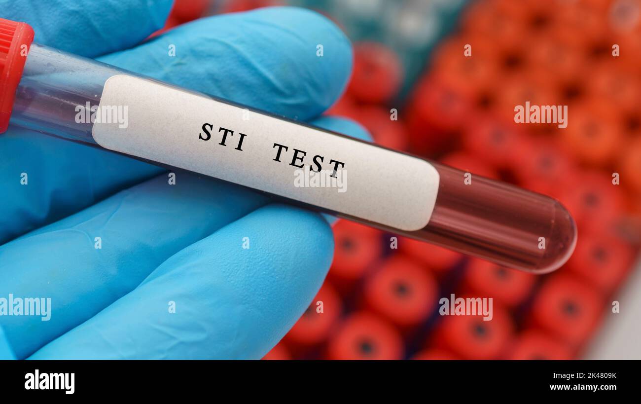 STI test, conceptual image Stock Photo - Alamy