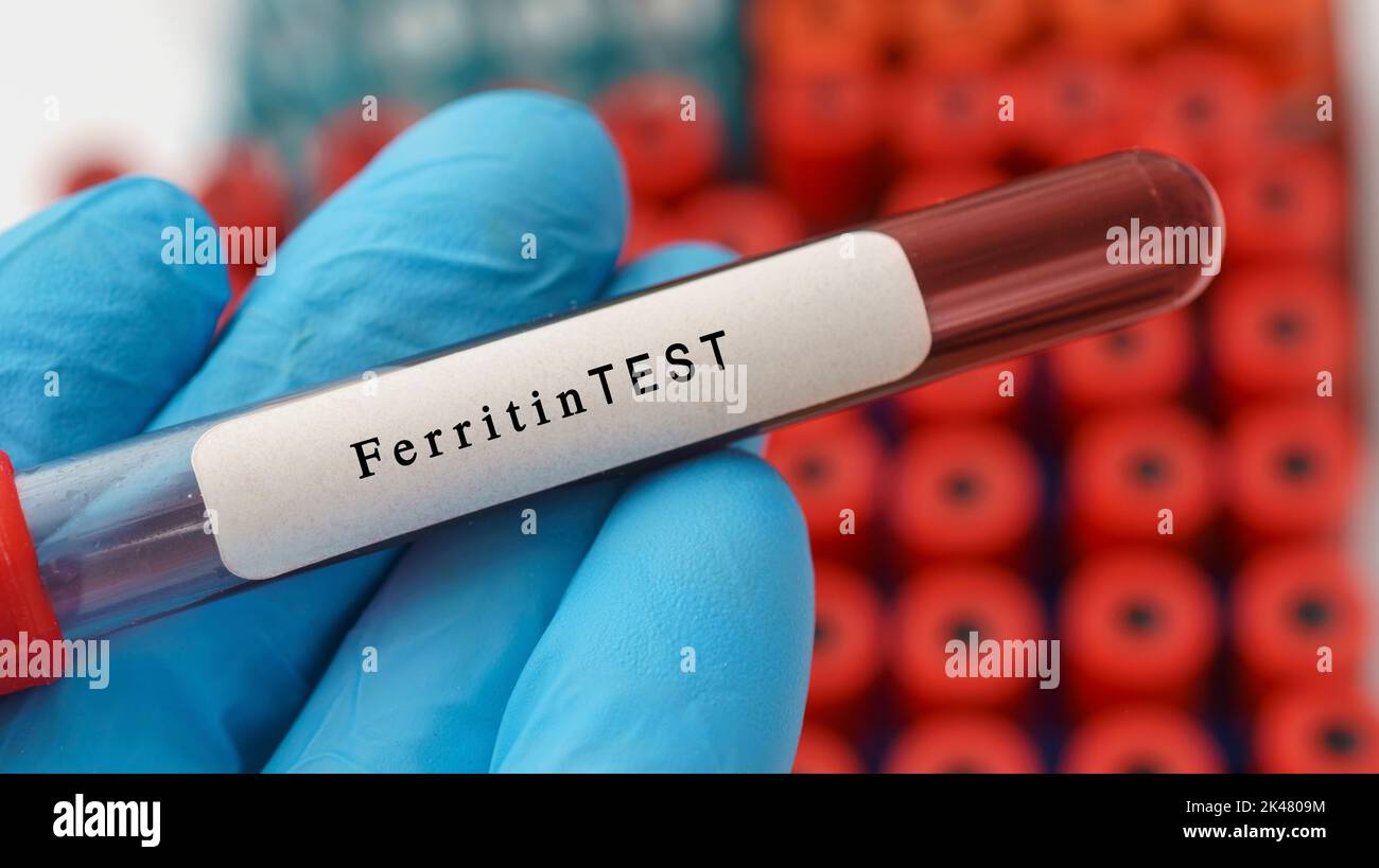 Ferritin test, conceptual image Stock Photo - Alamy