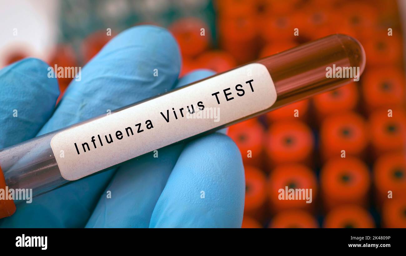 Influenza virus test, conceptual image Stock Photo - Alamy
