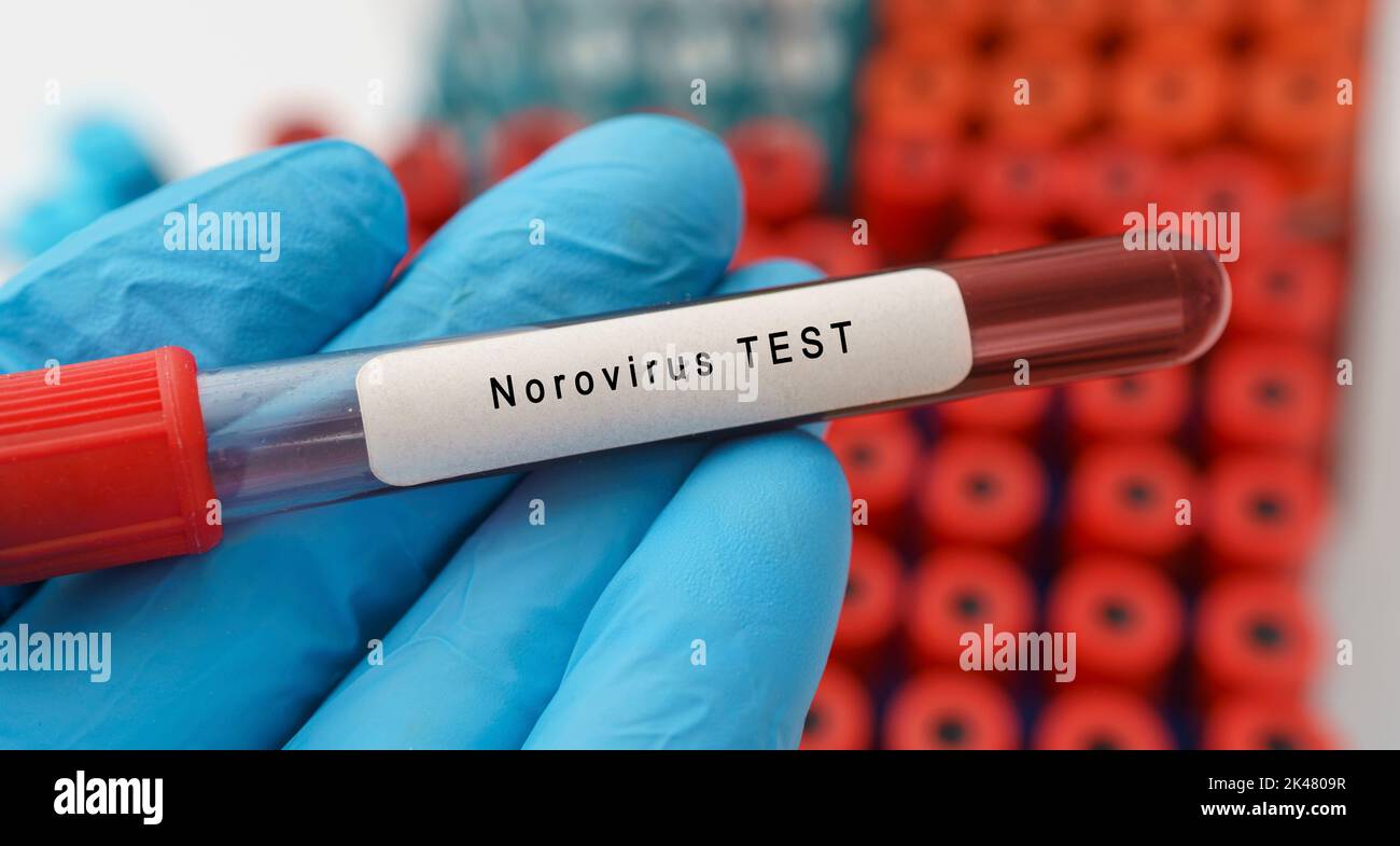 Norovirus test hi-res stock photography and images - Alamy