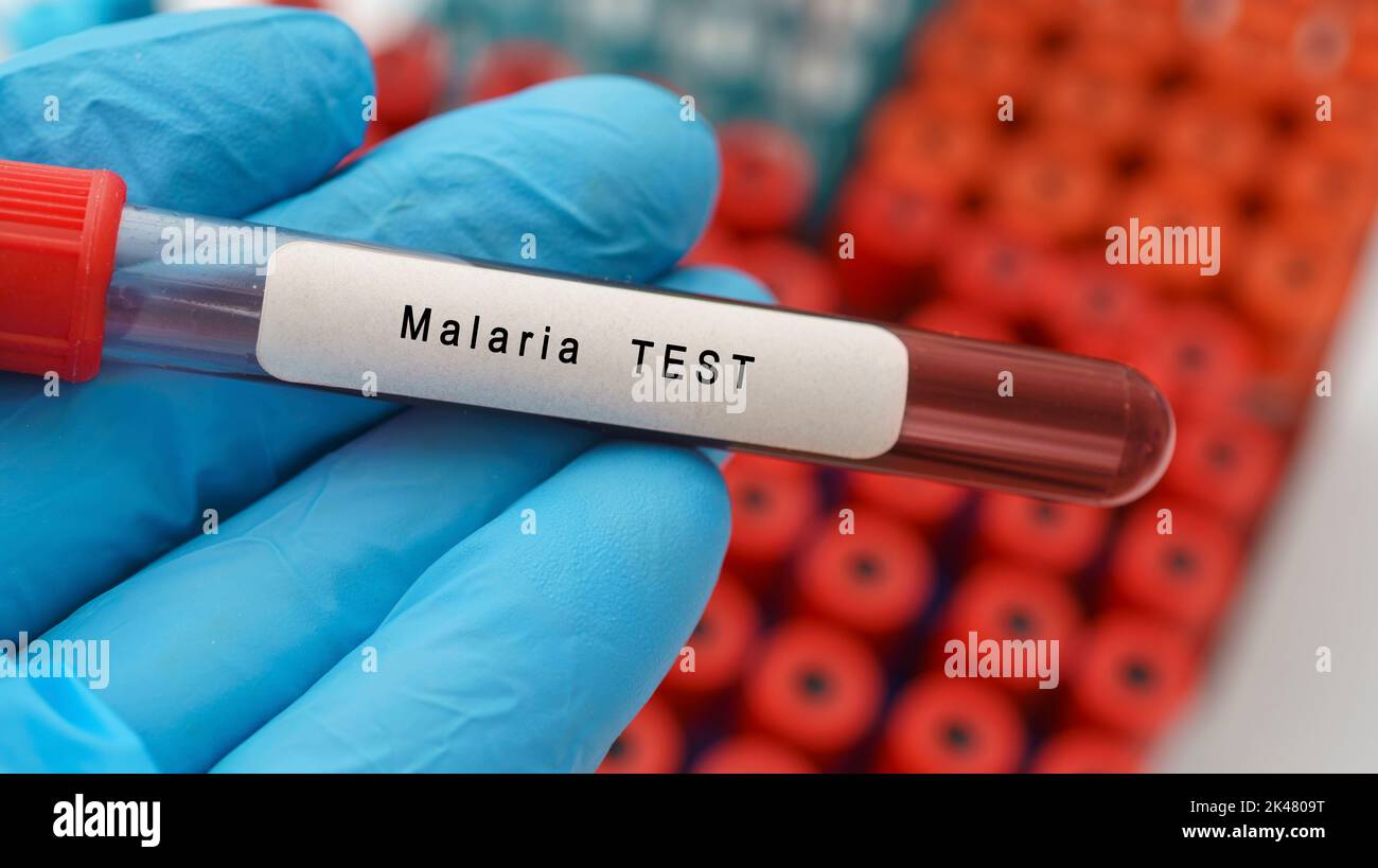 Malaria blood test, conceptual image Stock Photo - Alamy