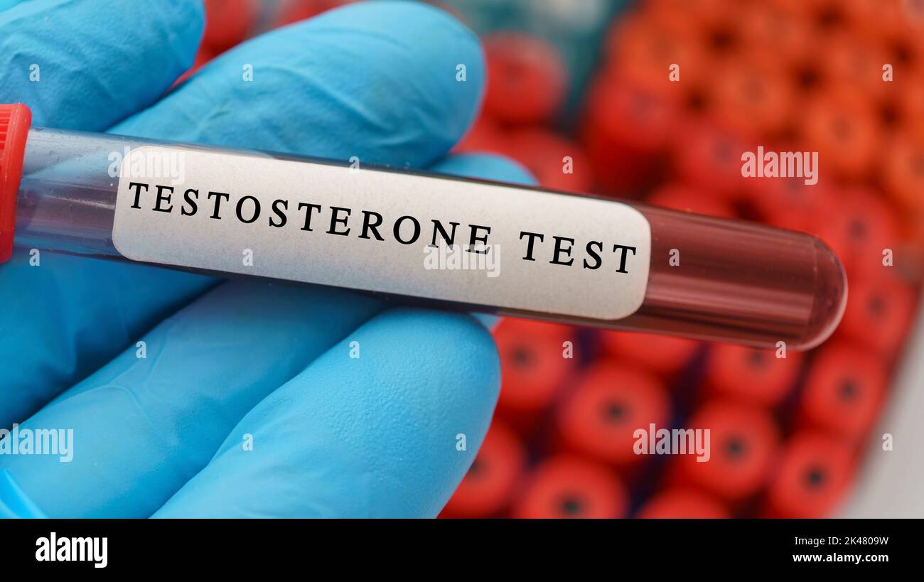 Test testosterone hi-res stock photography and images - Alamy
